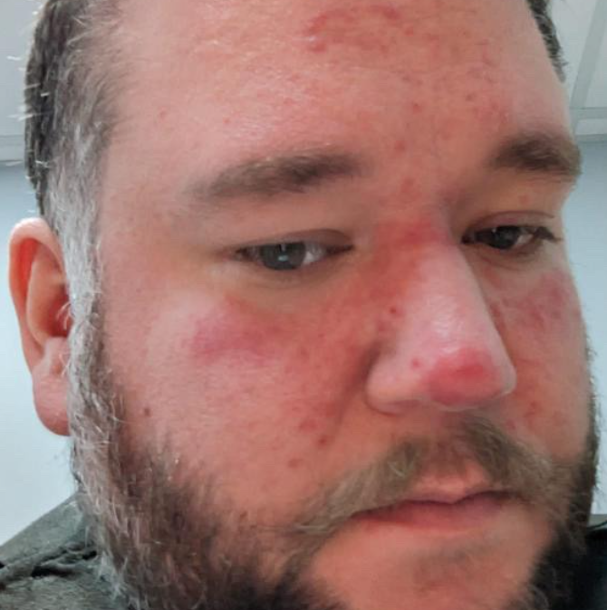 uncouth - your virtual dermatologist